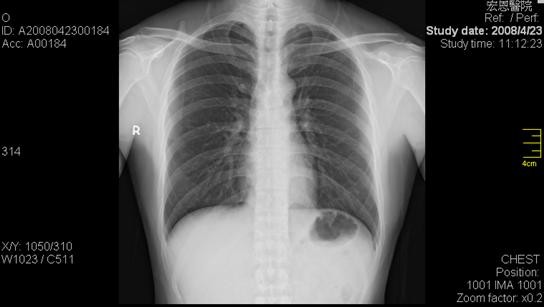 DICOM & GSDF 對灰階醫療螢幕的重要性及量測 (一)－Travis Chang｜痞客邦